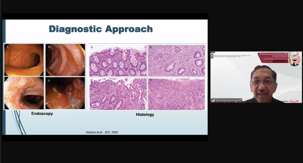 Inflammatory Bowel Disease (IBD) Scientific Webinar: Introduction to ...